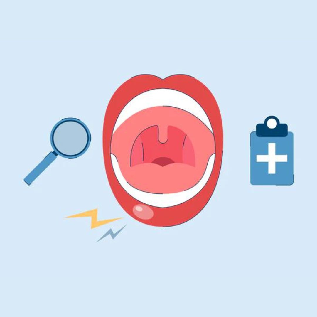 What Is A Mucous Cyst - Dr. Lakshmi Ramgopal