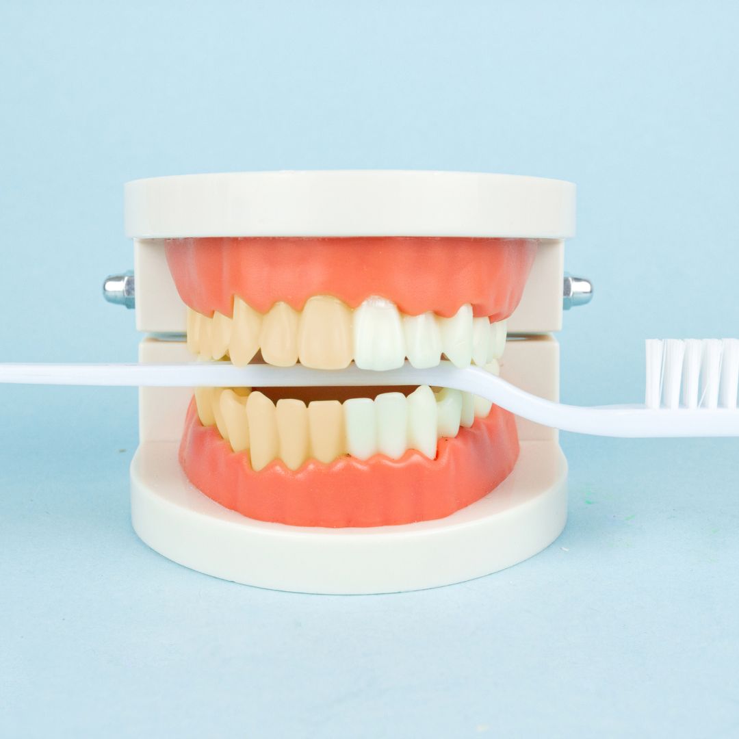 Are You Whitening Your Teeth Too Much? - Dr. Lakshmi Ramgopal